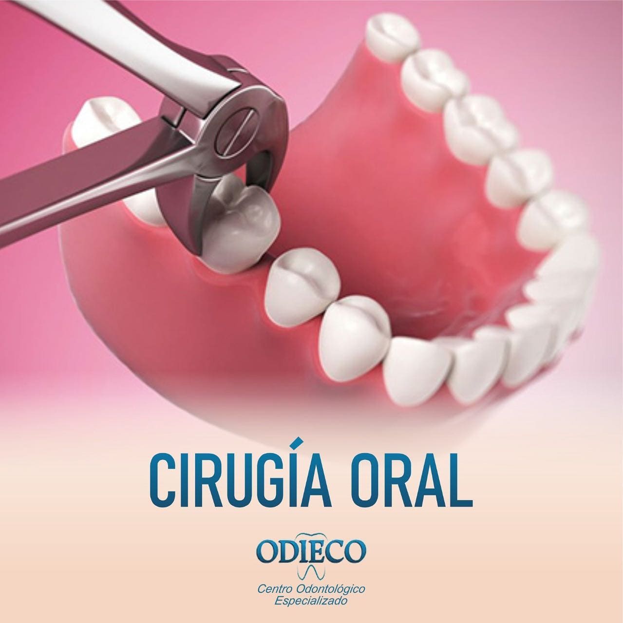 Cirugía Oral – ODIECO